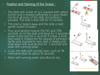 Slit skin smears | PPTX