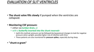 Slit ventricles syndrome - Dr Sameep Koshti (Consultant Neurosurgeon) | PPT