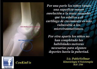 Sindrome Sinding-Larsen- Johansson | PDF