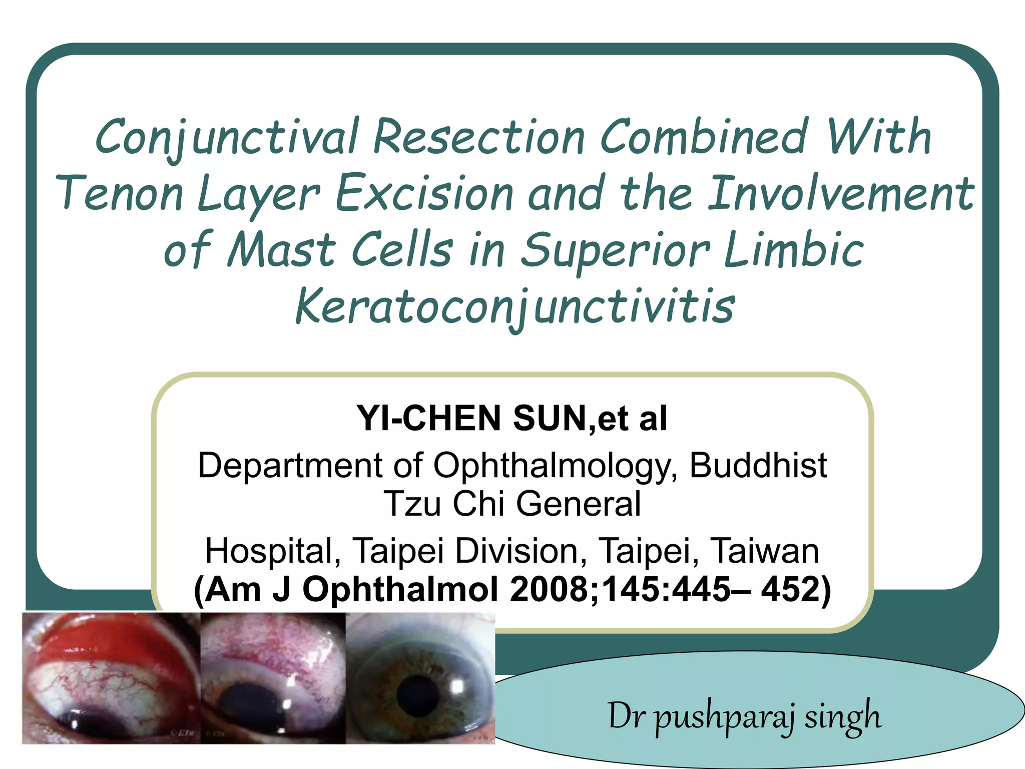 Superior limbic keratoconjunctivitis | PPT