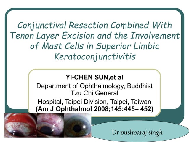 Superior limbic keratoconjunctivitis | PPT | Eye and Vision Conditions ...