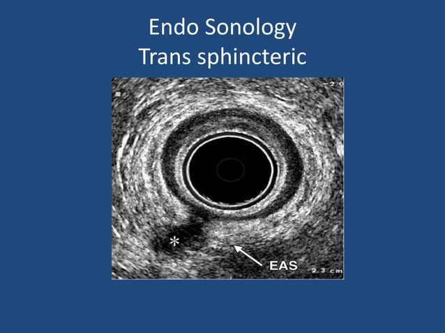 SLOFT SURGERY PRESENTATION | PPTX