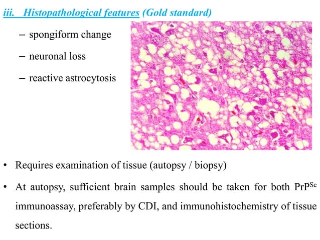Slow virus disease | PPSX