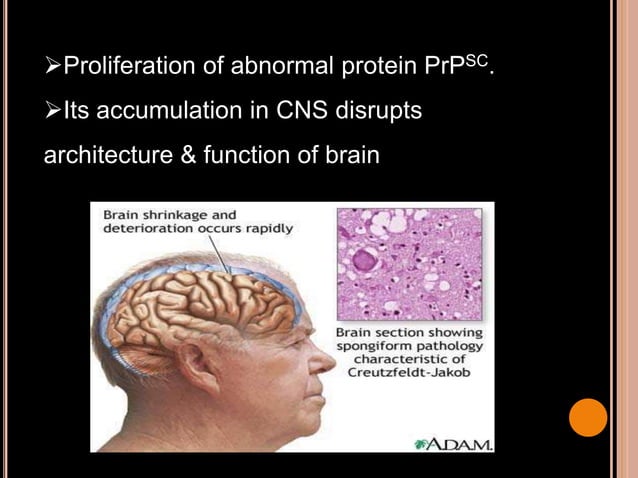 Slow virus diseases | PPTX