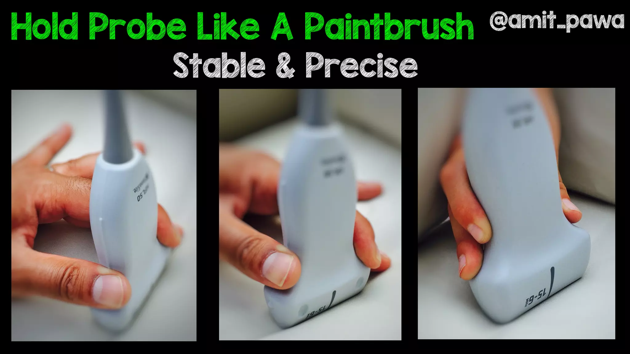 Fundamentals of Regional Anaesthesia & Plan A Blocks | PDF