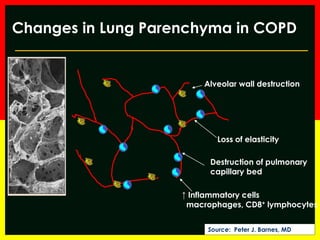 Chronic Obstructive Pulmonary Disease | PPTX