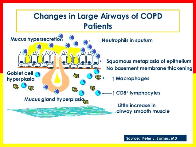 Chronic Obstructive Pulmonary Disease