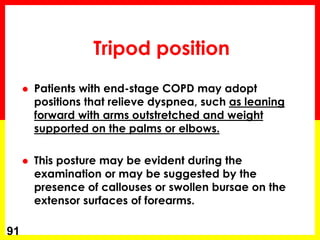 Tripod Position Copd