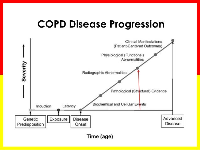 COPD