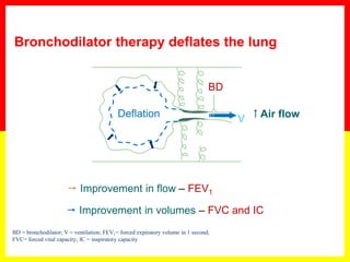 Chronic Obstructive Pulmonary Disease | PPTX