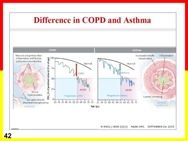 Asthma-COPD Overlap Syndrome (ACOS) | PPTX | Lung and Respiratory Health | Diseases and Conditions