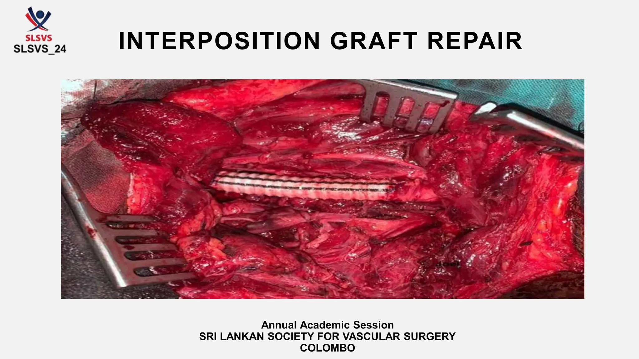 Traumatic vascular injuries in the neck; principles of management Joel ...
