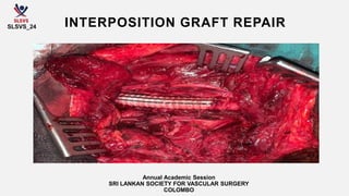 Traumatic vascular injuries in the neck; principles of management Joel ...