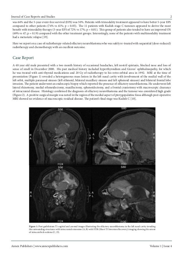 Olfactory Neuroblastoma Esthesioneuroblastoma Following Retro Orbit