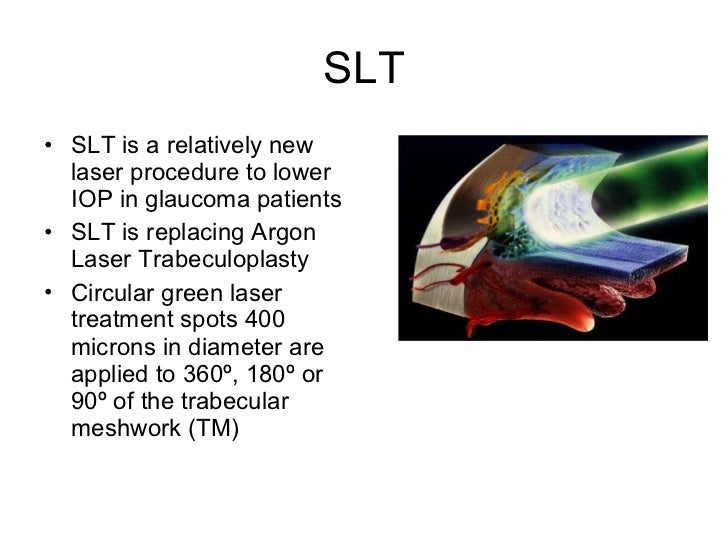 Slt Lens Presentation