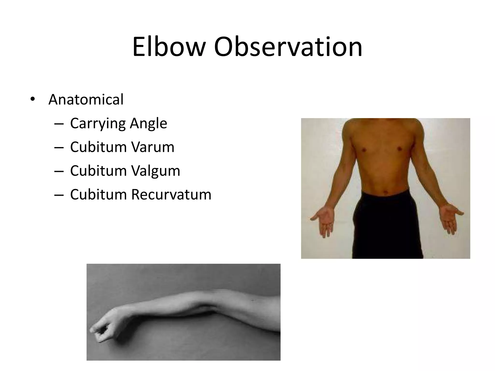 Carrying Angle | PPTX