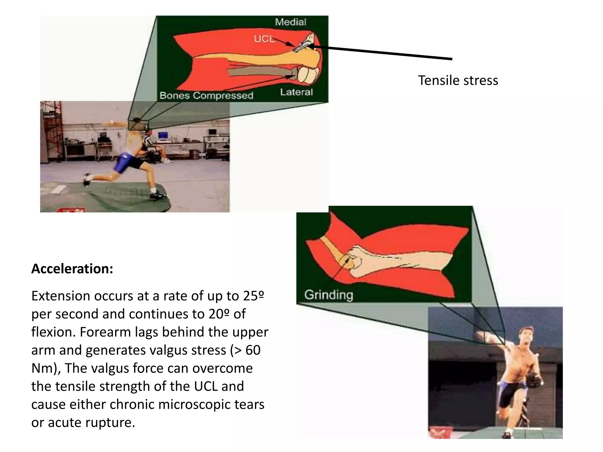 Carrying Angle | PPTX