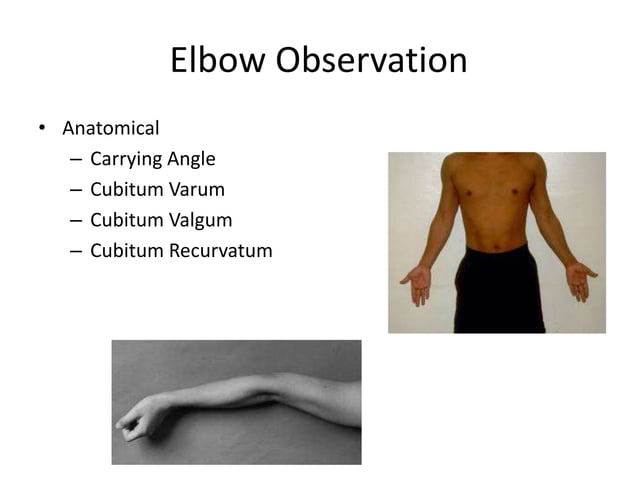 Carrying Angle | PPTX | Death, Injury, or Military Conflict | Sensitive ...