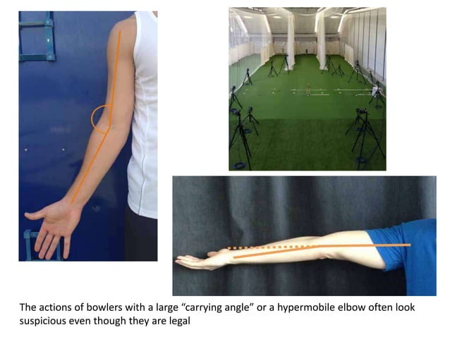 Carrying Angle | PPTX | Death, Injury, or Military Conflict | Sensitive ...
