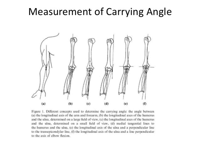 Carrying Angle