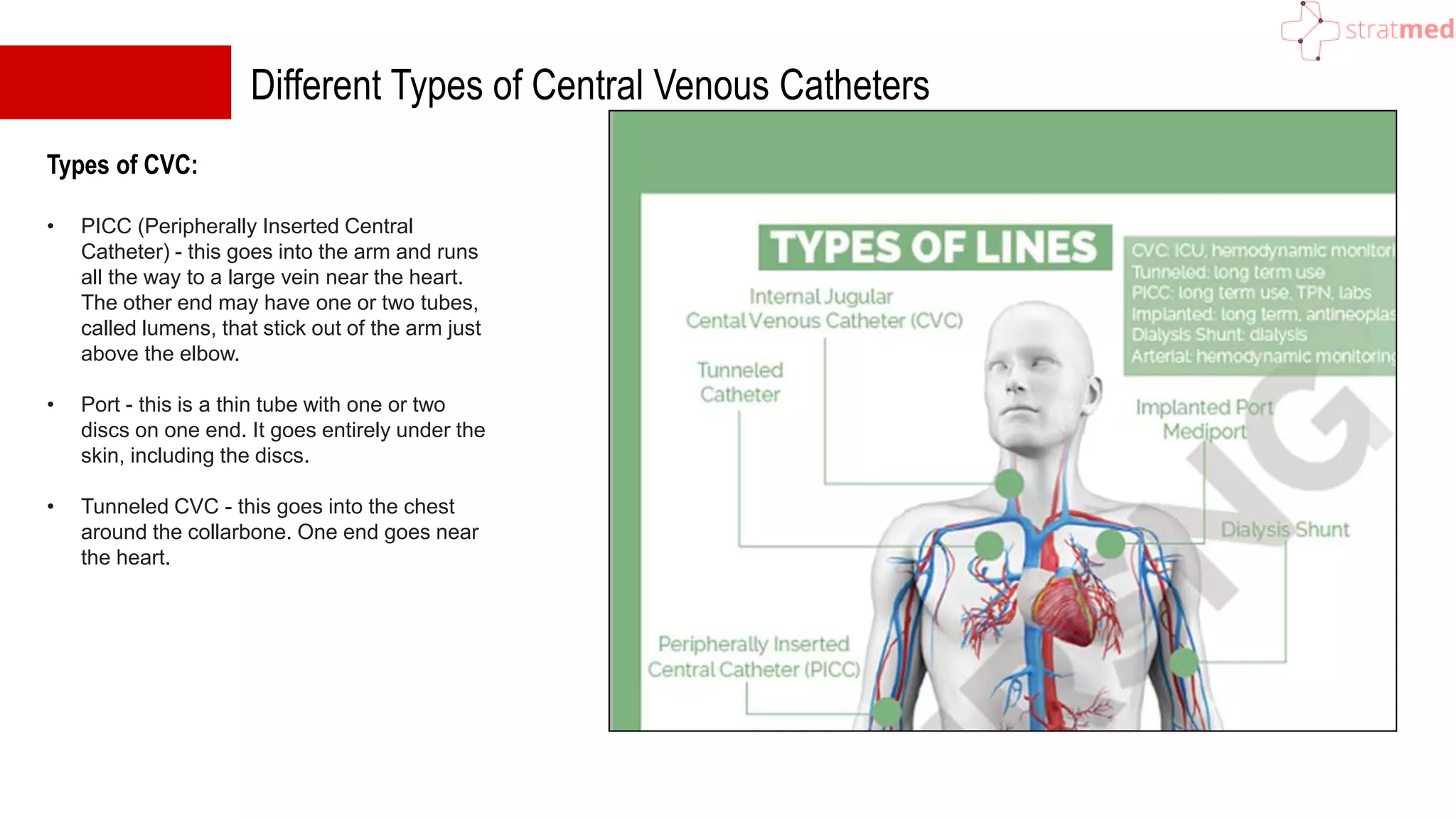 PPT - central line(Central Venous Catheters) | PPTX
