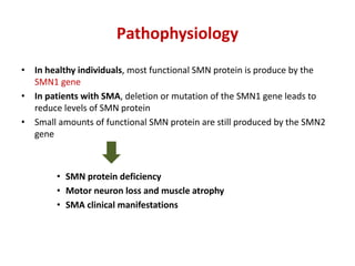 SMA.pdf | Physical Therapy | Wellness