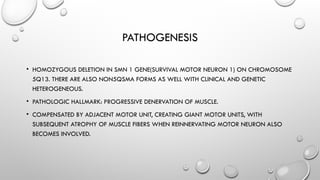Spinal muscular atrophy, pathophysiology, genetics | PPTX