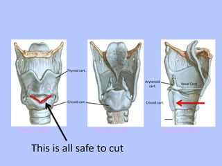 Smacc 2014 Cric Anatomy Slides | PPTX