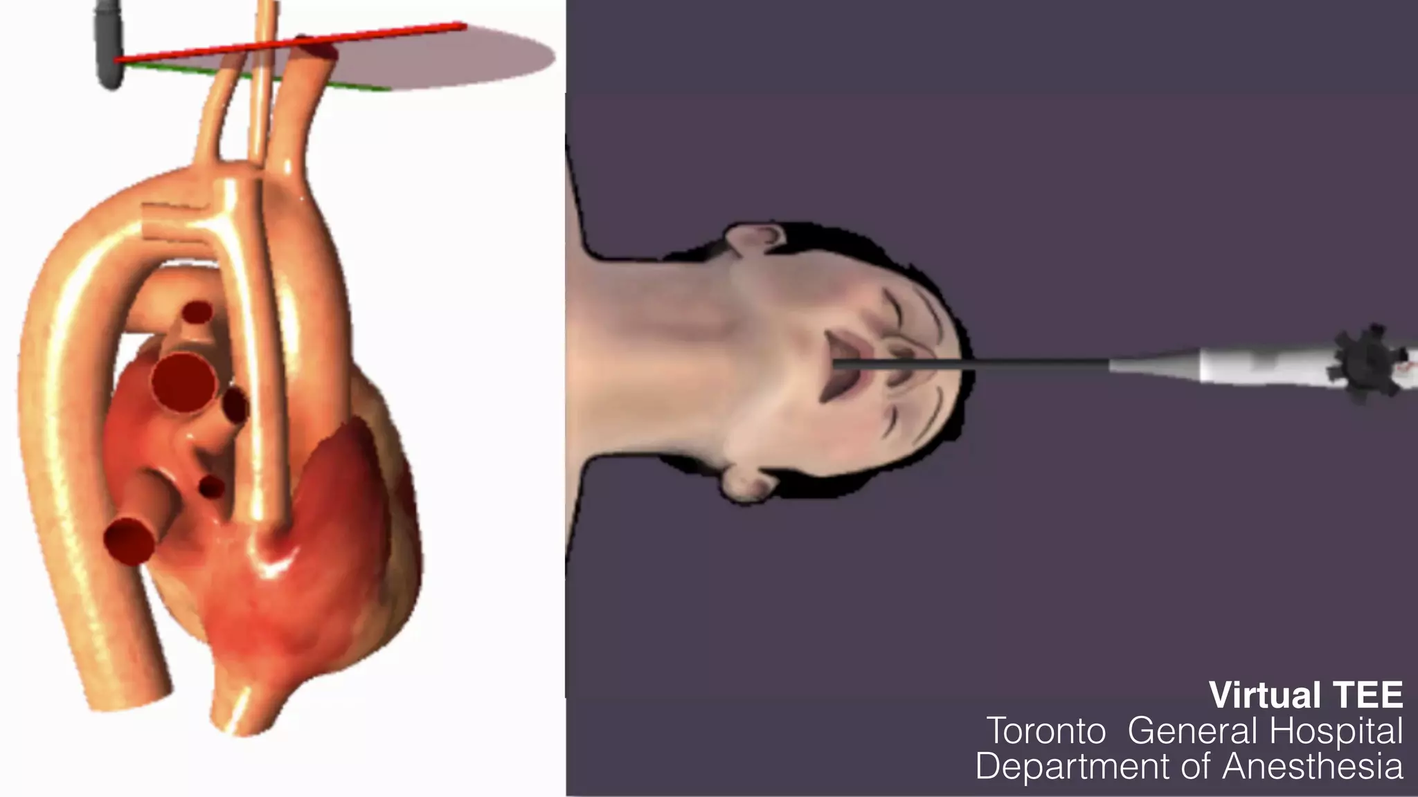 Airway Ultrasound: Confirming Endotracheal Tube Placement | PDF