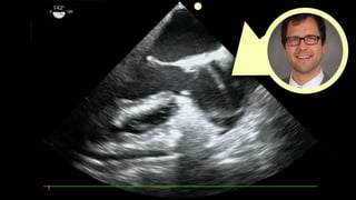 Airway Ultrasound: Confirming Endotracheal Tube Placement | PDF