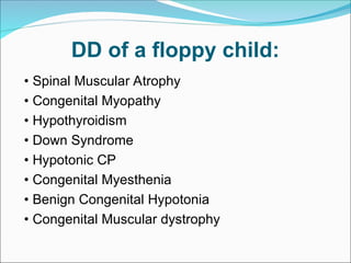Spinal muscular atrophy presentation by dr Afjal | PPT