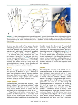 Small-Joint-Denervation-of-the-Hand-and-Thumb-Base.pdf