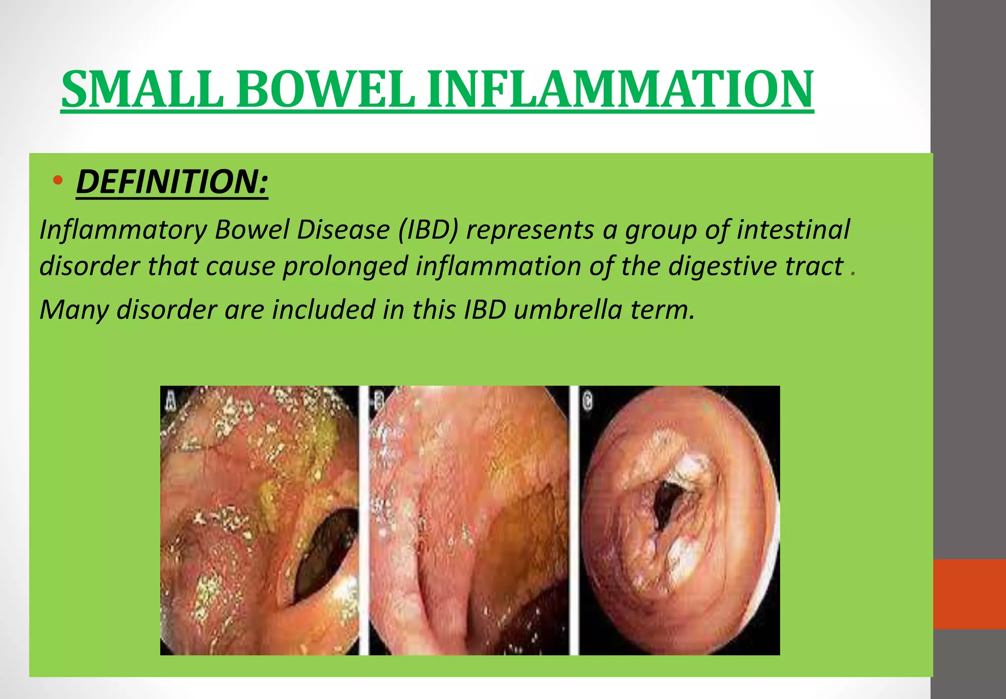 Presentation on small intestine disorder | PPTX