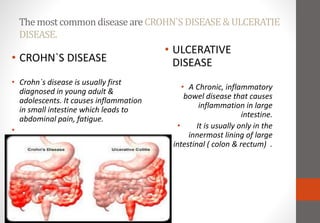 Presentation on small intestine disorder | PPTX