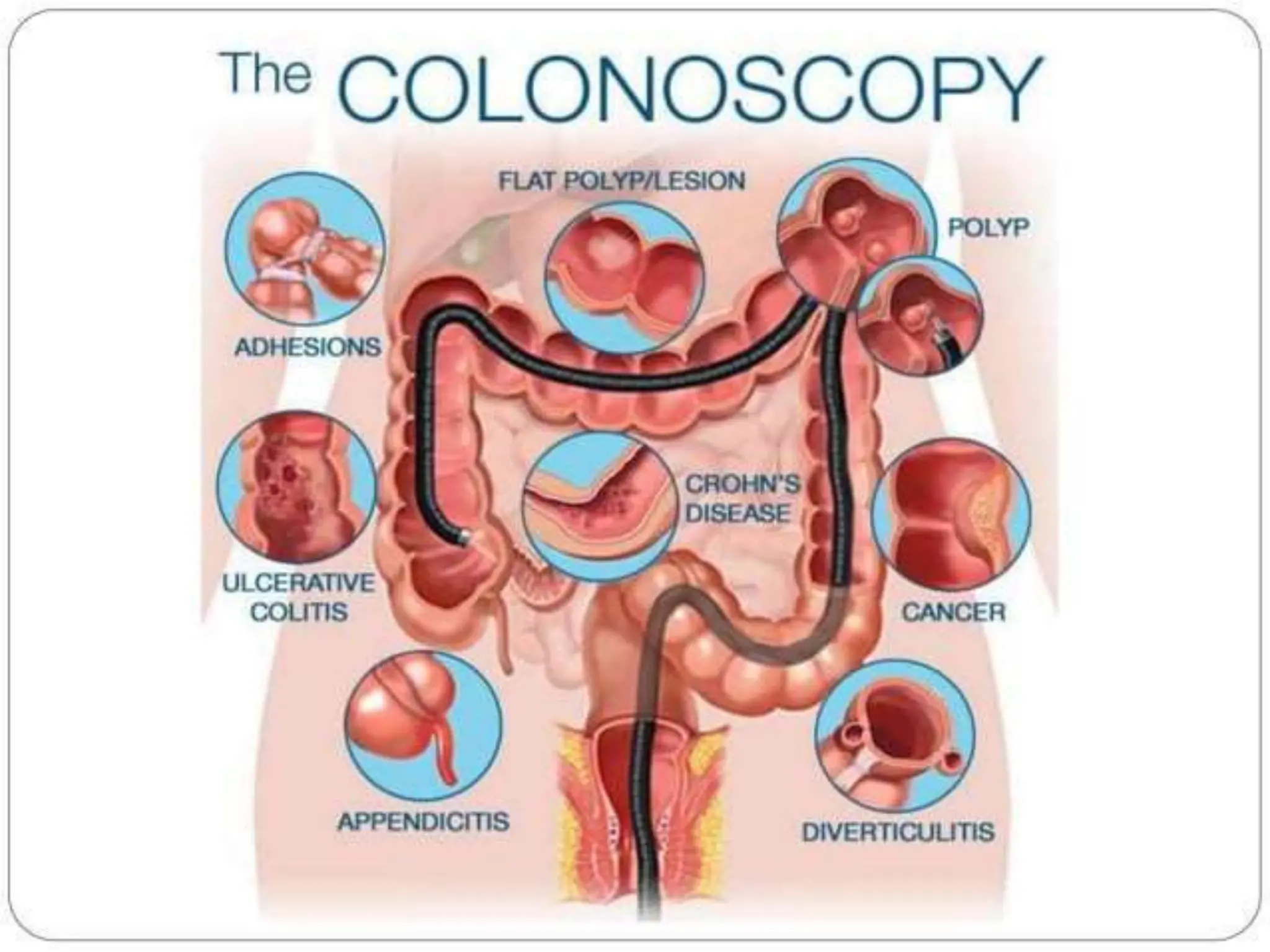 Anatomy of small and large Bowel PPT.pptx