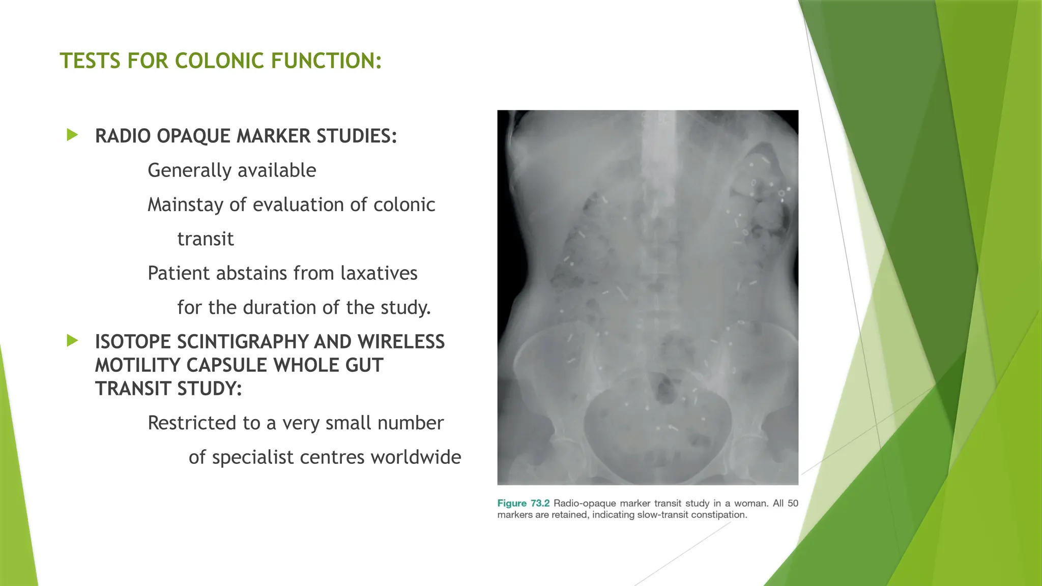 small and large intestine applied anatomy.pptx