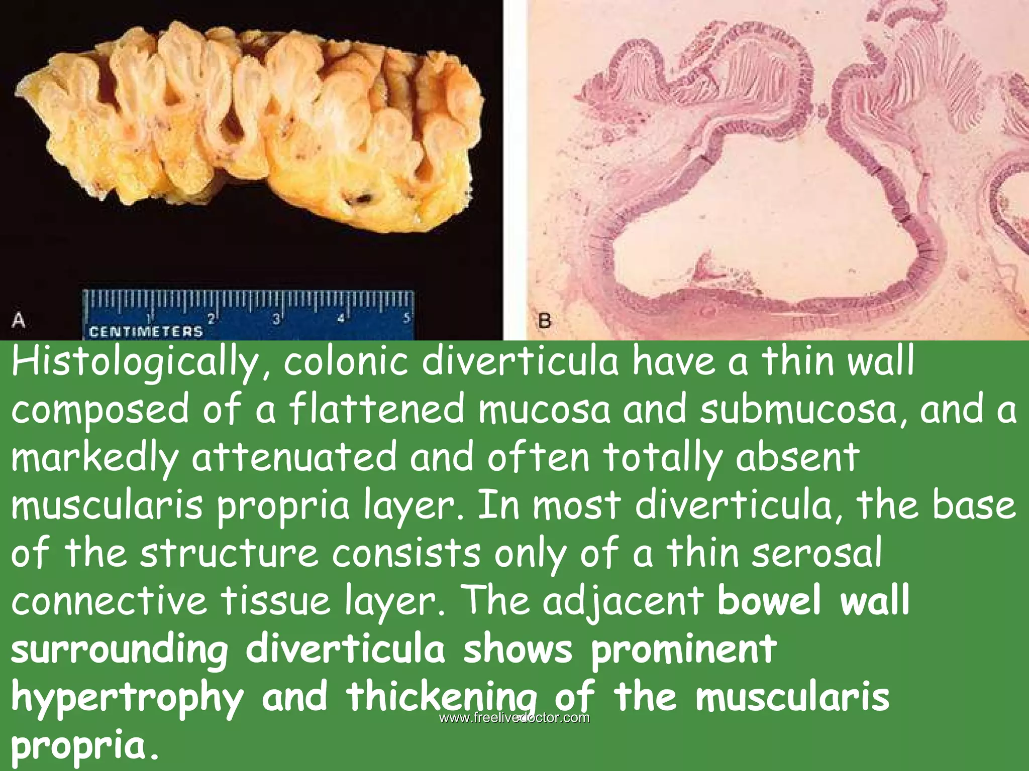 Small and large intestine pathology | PPT