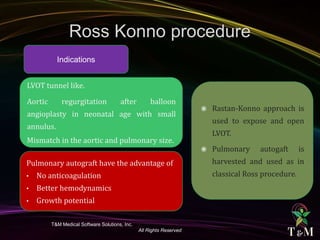 Small aortic root | PPTX