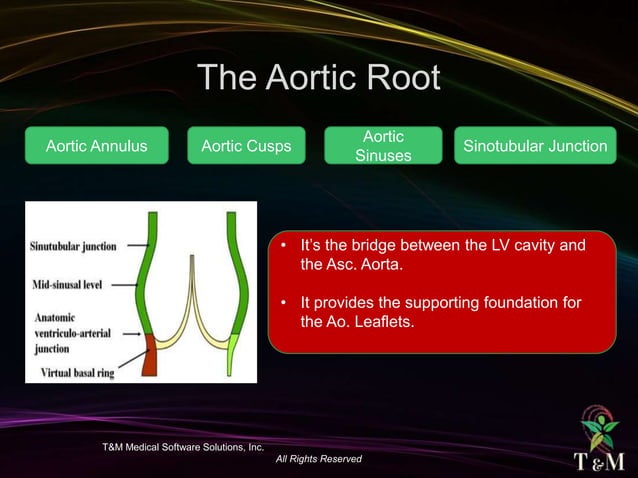 Small aortic root | PPT