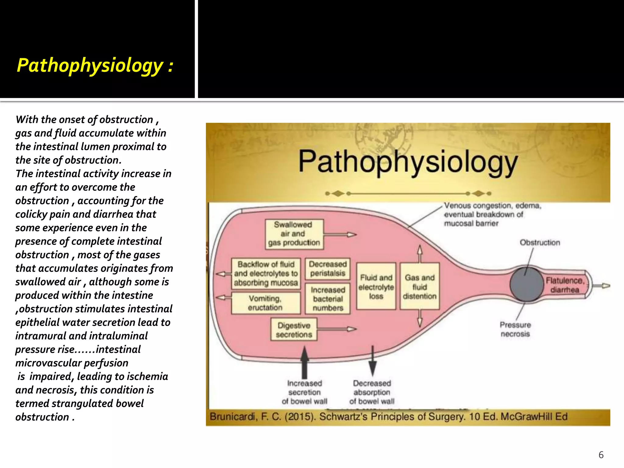 Small bowel obstruction | PPTX