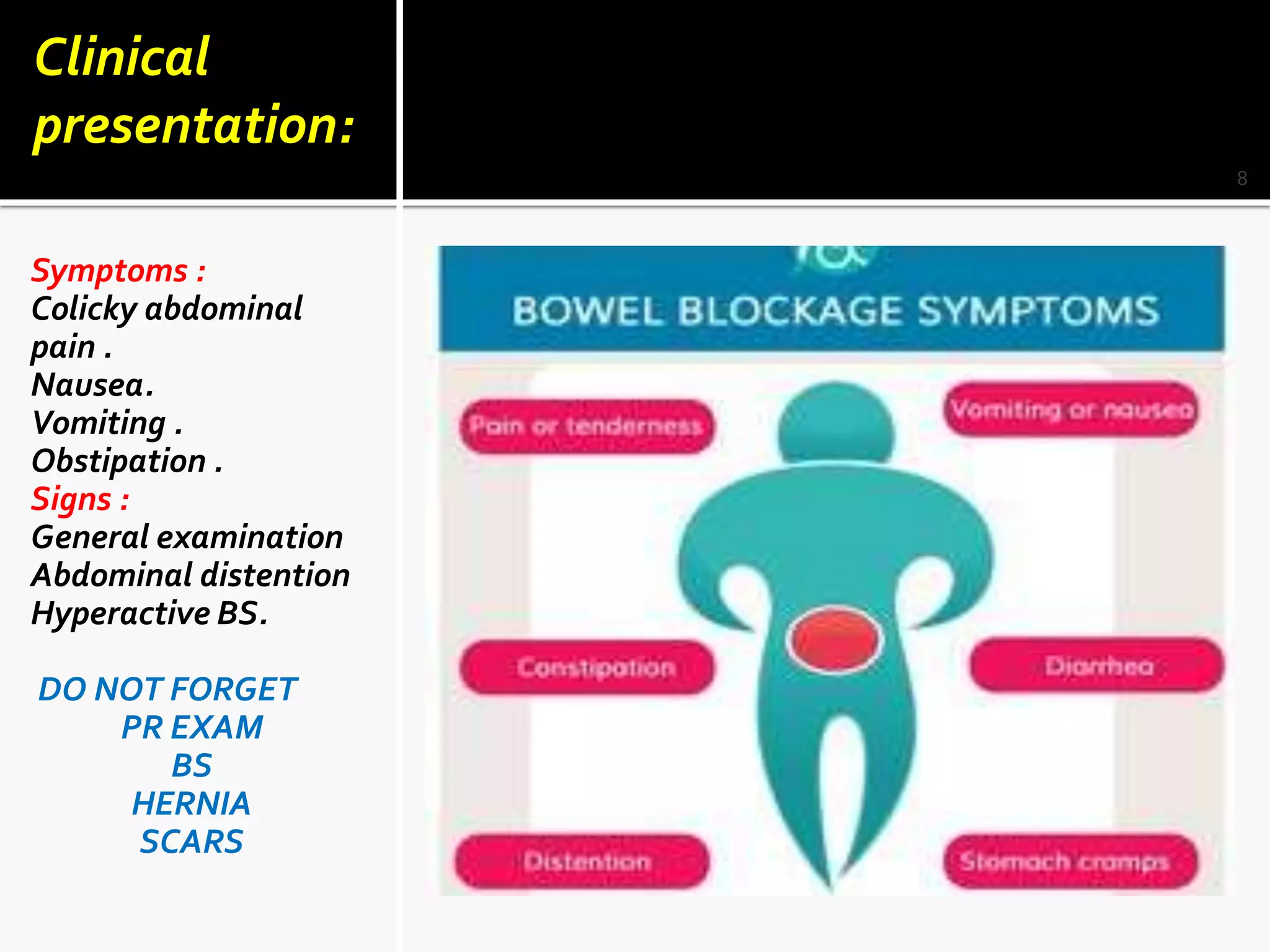 Small bowel obstruction | PPTX