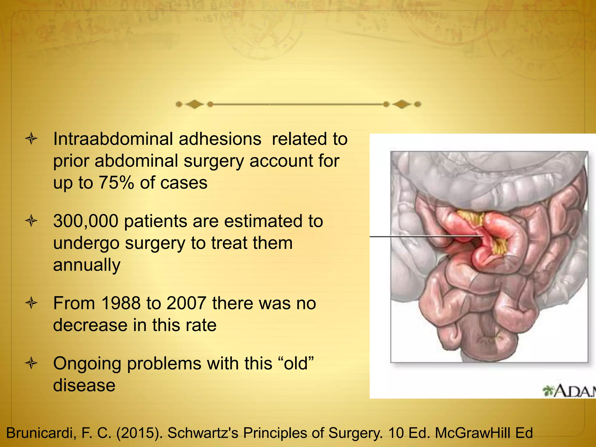 Small bowel obstruction and Intestinal Fistulas | PPTX | Digestive ...