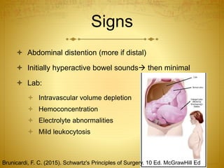 Small bowel obstruction and Intestinal Fistulas | PPTX | Digestive ...