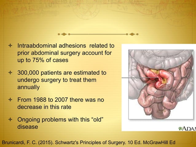 Small bowel obstruction and Intestinal Fistulas