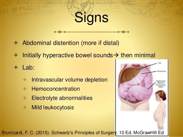 Small bowel obstruction and Intestinal Fistulas