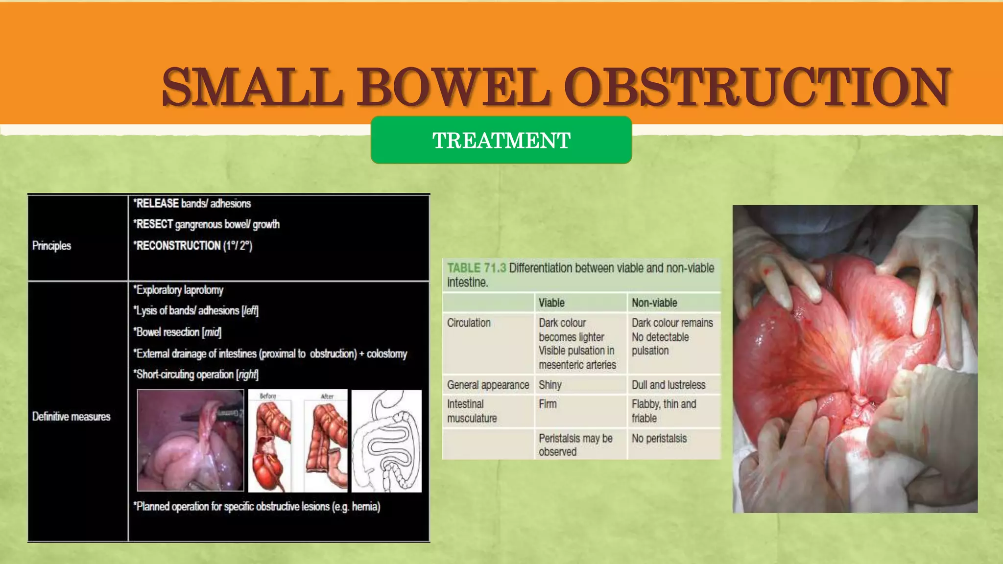 Small bowel obstruction/ Generalised abdominal pain | PPTX