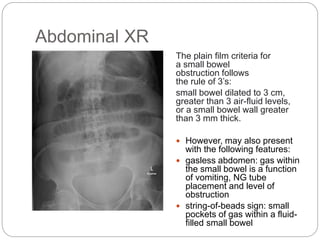 Small Bowel obstruction presentation.pptx