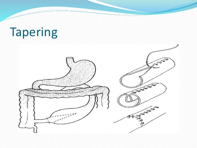 Short bowel syndrome