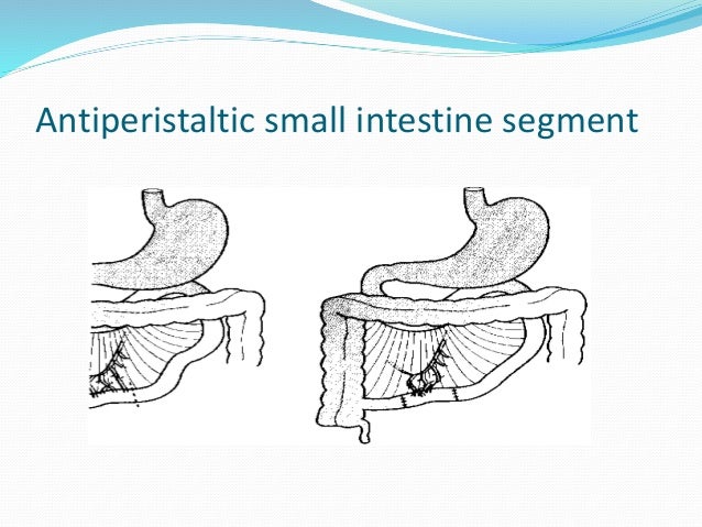 Short bowel syndrome