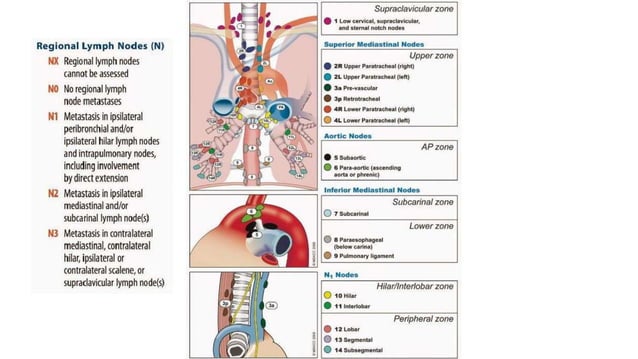 Small cell lung cancer | PPTX | Cancer | Diseases and Conditions